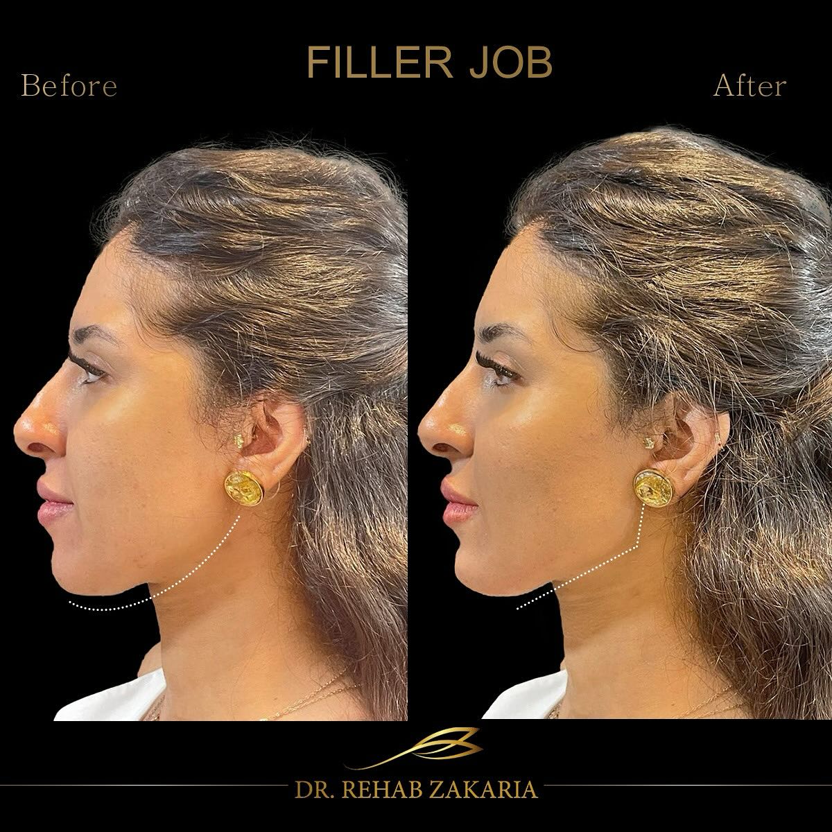 Check The Best Dermatology in Cairo Reults - Rehab Zakaria